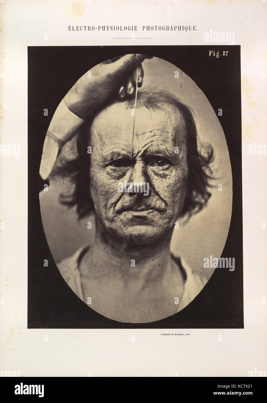 Procerus hi-res stock photography and images - Alamy