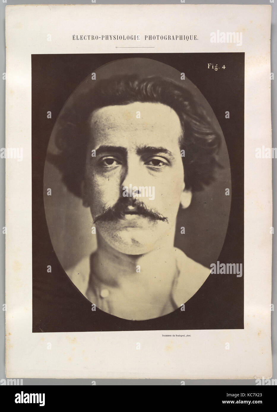 Figure 4: The face in repose of a young man, Guillaume-Benjamin-Amand ...