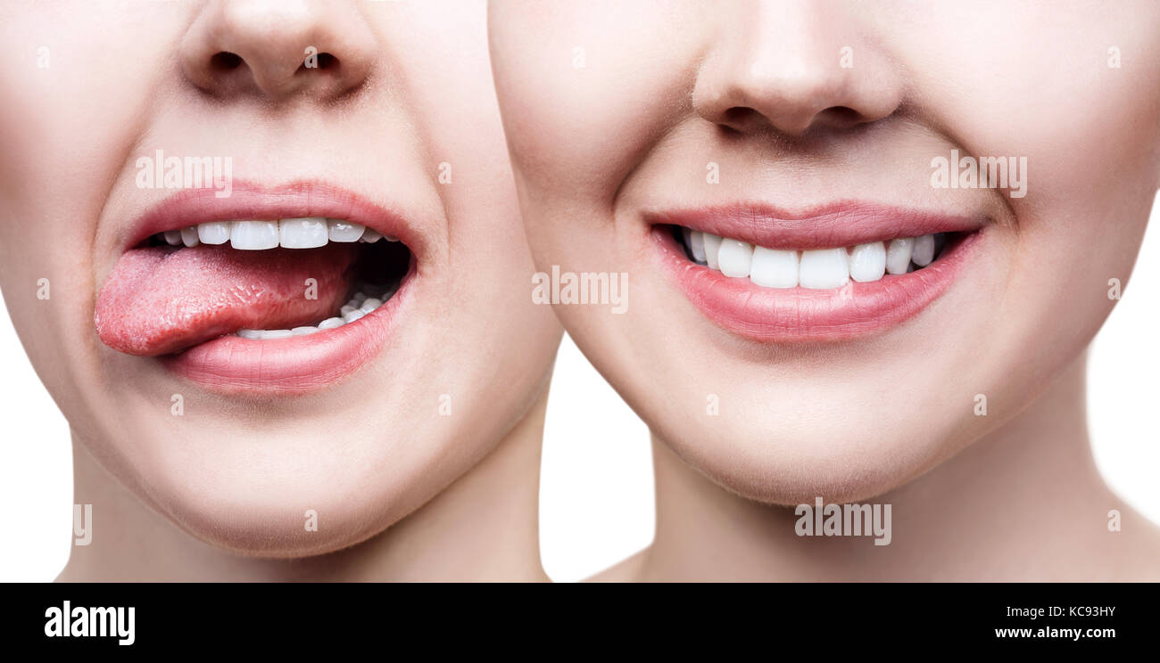 Collage of perfect female teeth closeup Stock Photo - Alamy