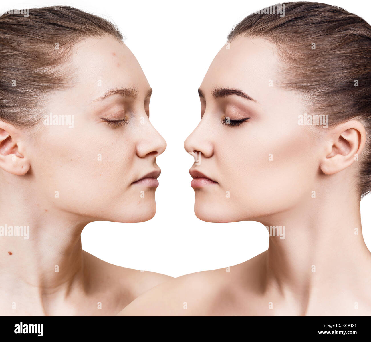 Young woman without and with makeup Stock Photo - Alamy