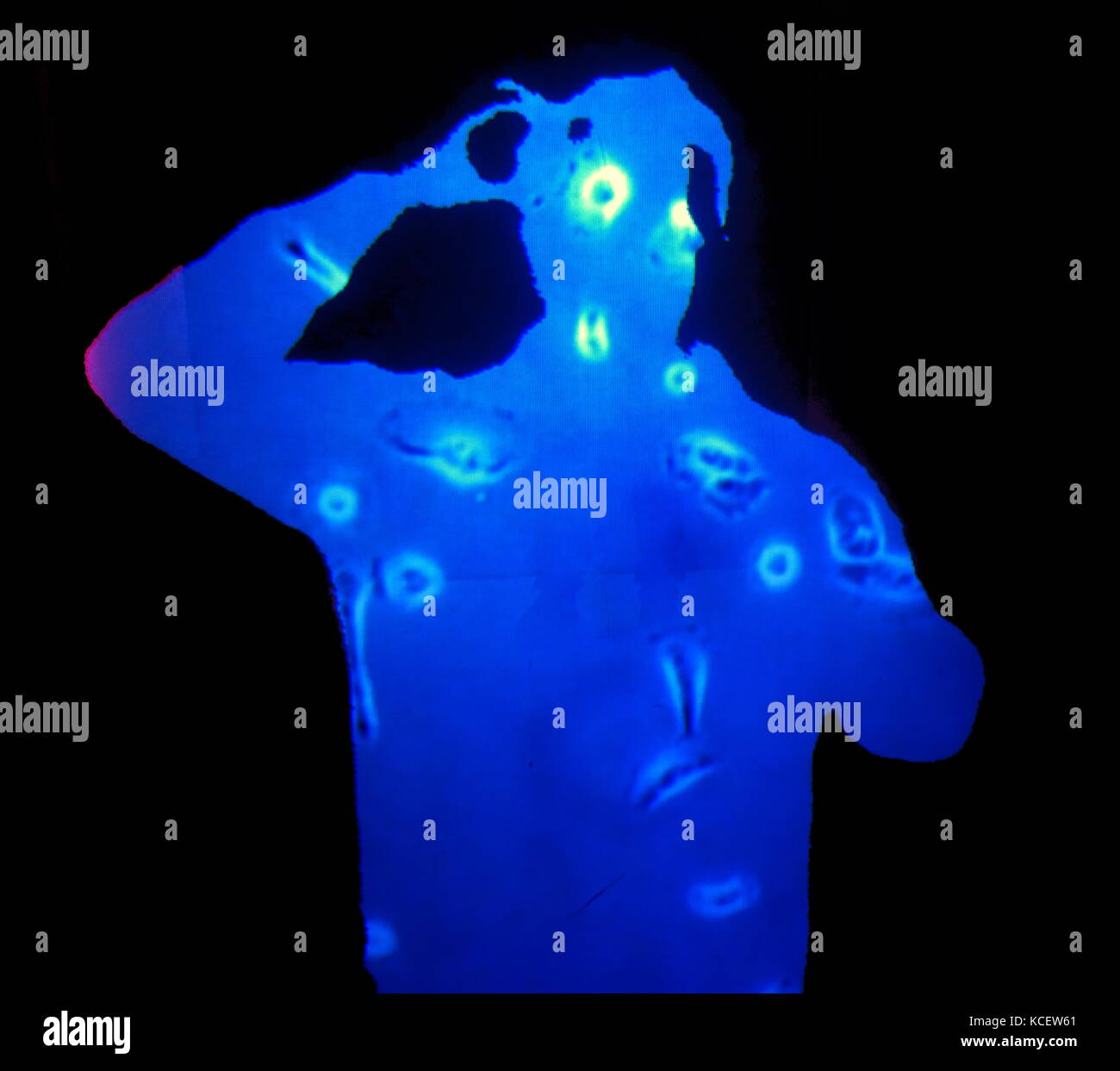 Infrared thermography (IRT), thermal imaging, and thermal video are ...