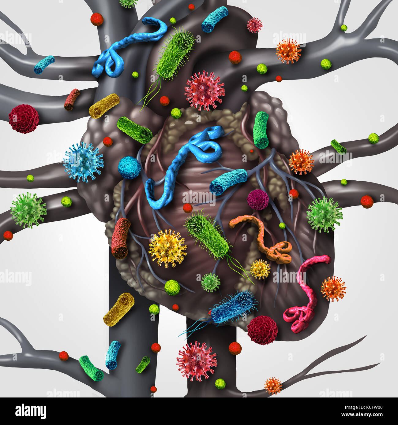 Heart infection and medical symbol for myocarditis disease and ...
