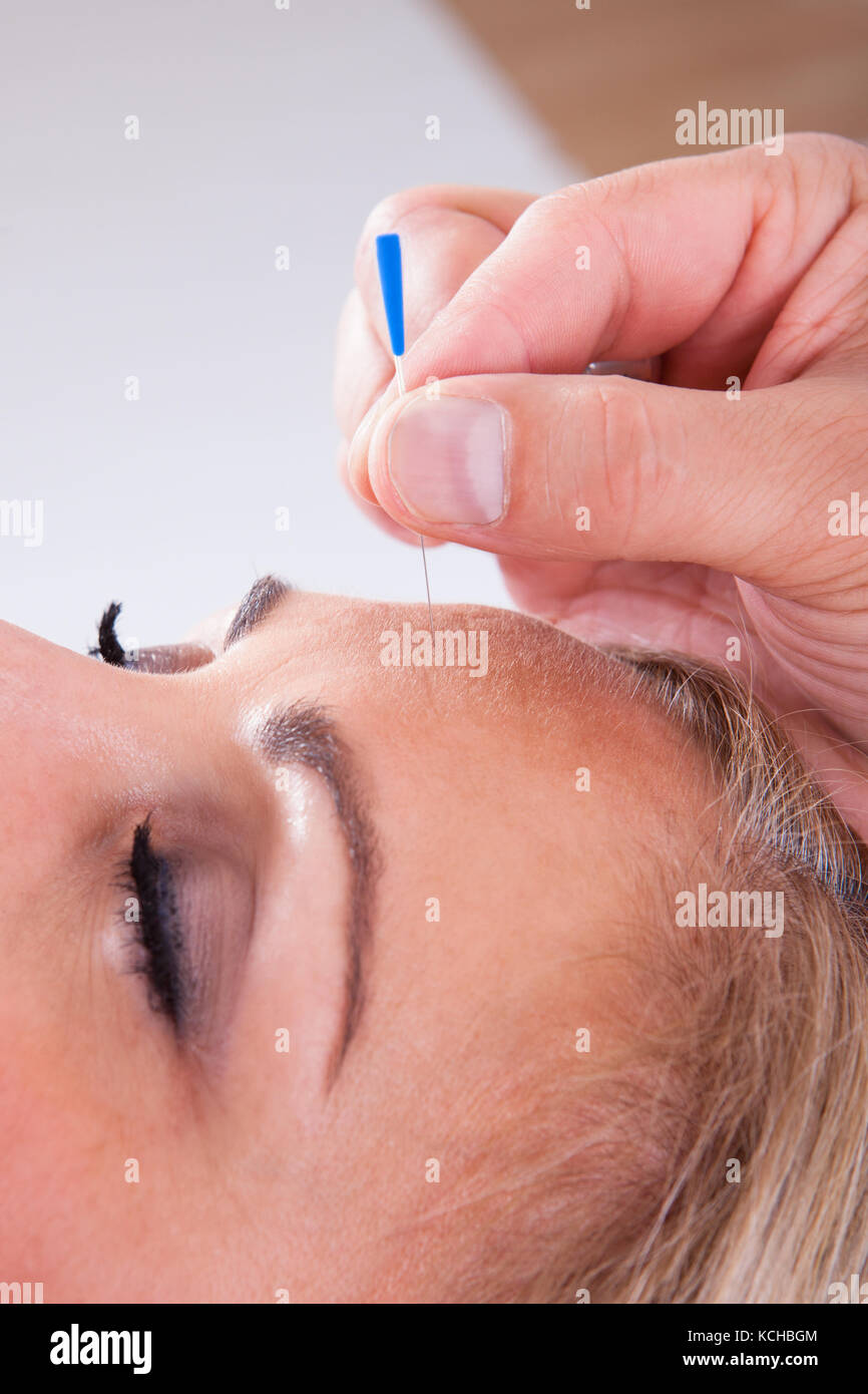 Young Beautiful Woman In An Acupuncture Therapy In A Spa Center Stock ...