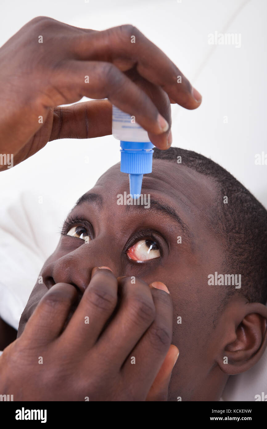 Eye drop bottle hi-res stock photography and images - Alamy