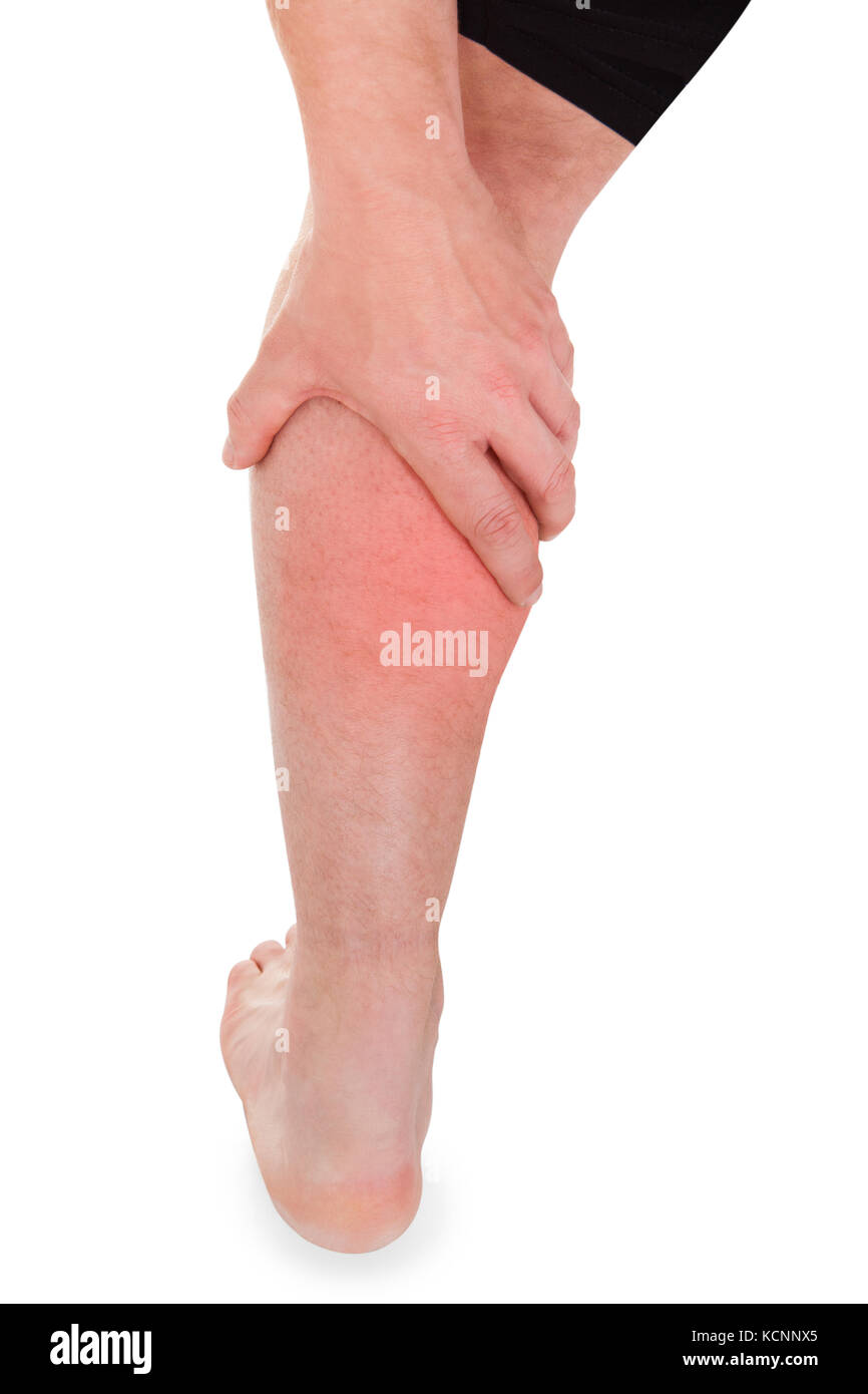 Mild Edema