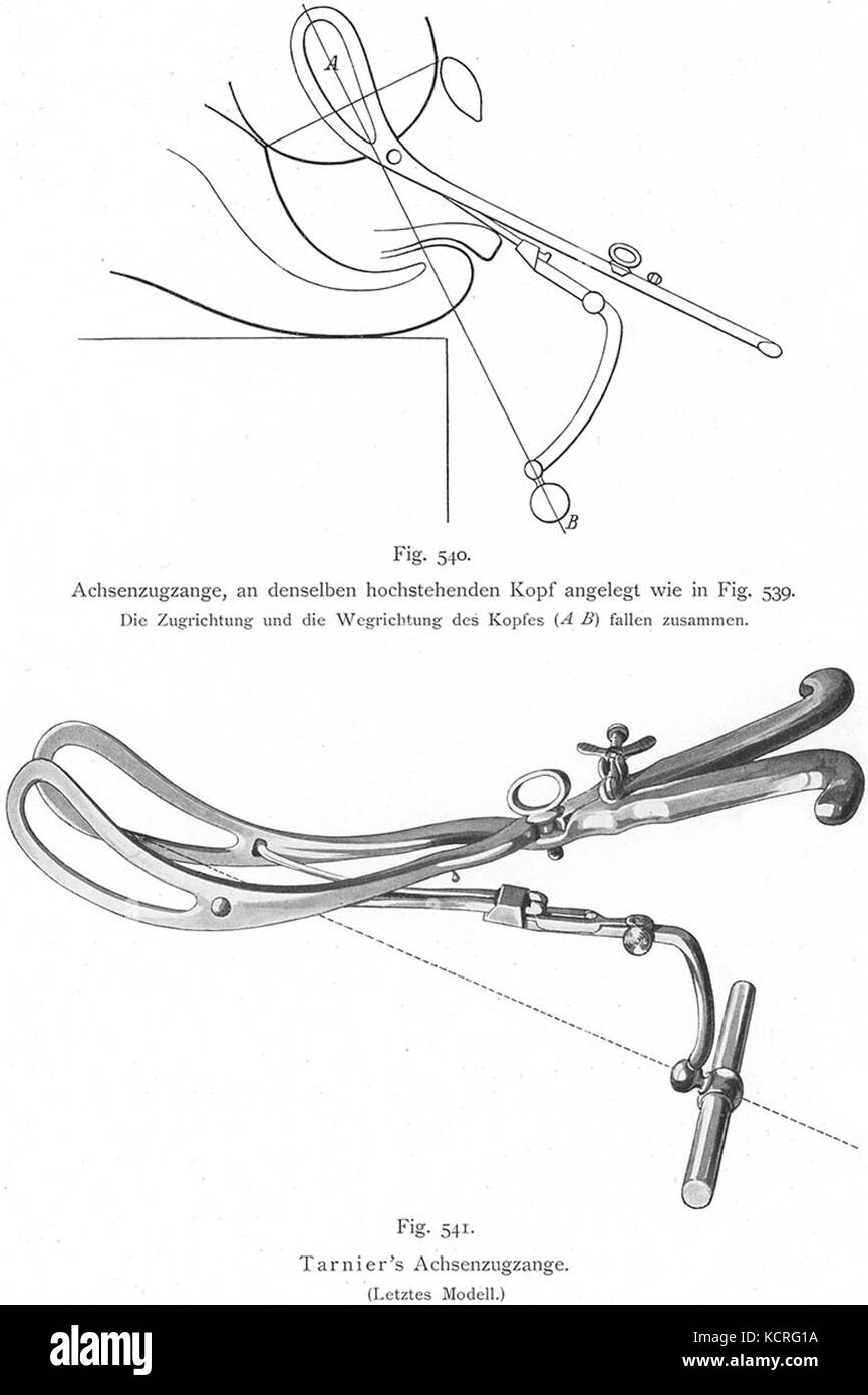 Bumm 540 lg Stock Photo - Alamy