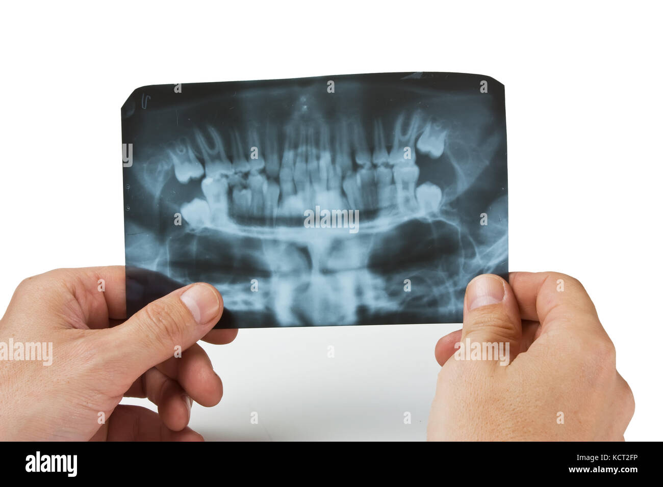 hand holds radiograph isolated on a white background Stock Photo - Alamy