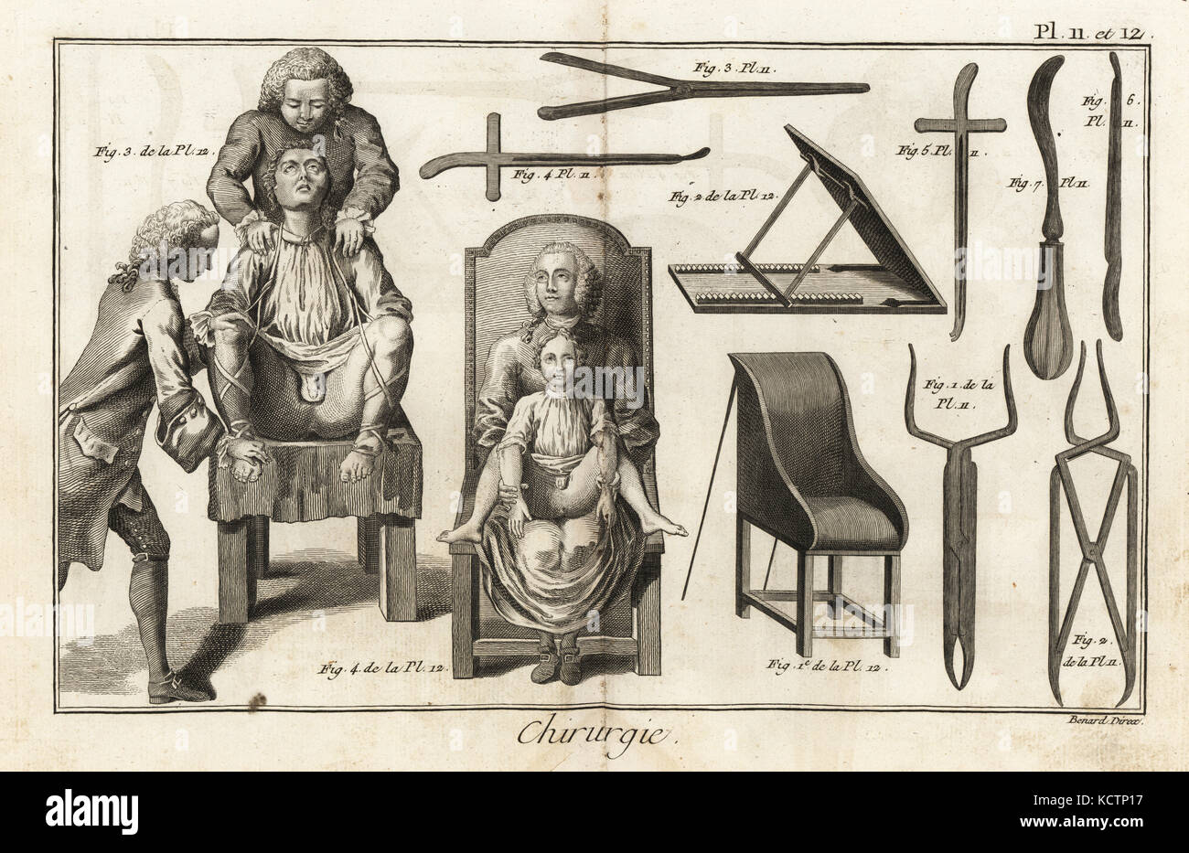 18th century surgical instruments hi-res stock photography and images ...