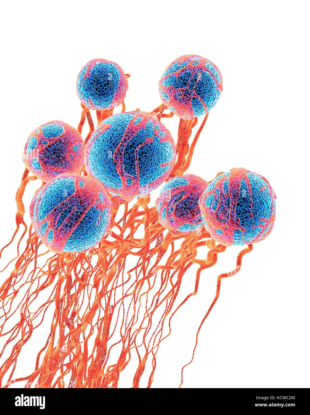 Cancer cells. Computer illustration of cancer cells, showing the blood ...