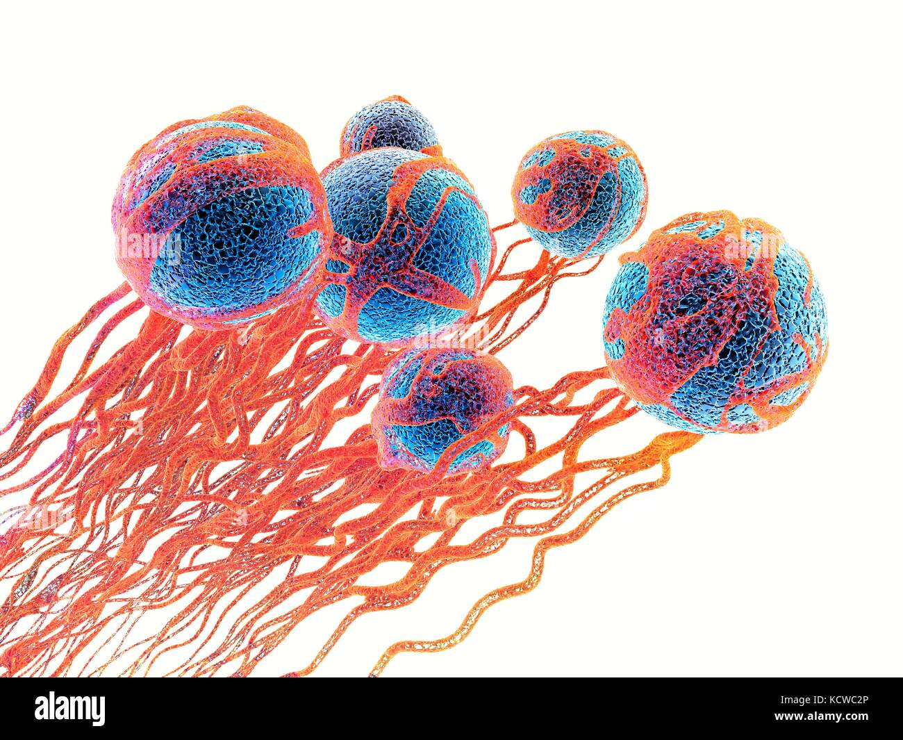 Cancer cells. Computer illustration of cancer cells, showing the blood ...