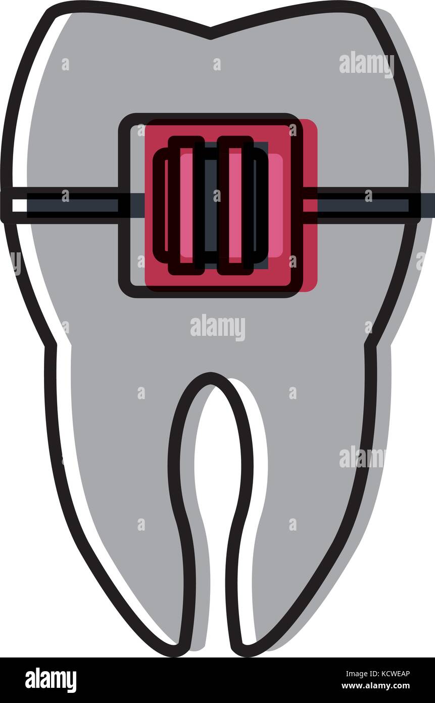 Tooth with bracket Stock Vector Images - Alamy