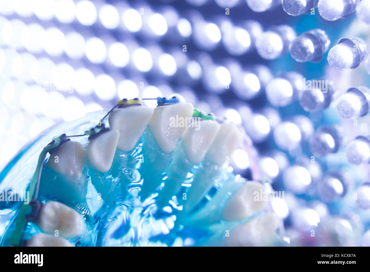 Dental teeth retainers metal aligners brackets to straighten teeth in ...