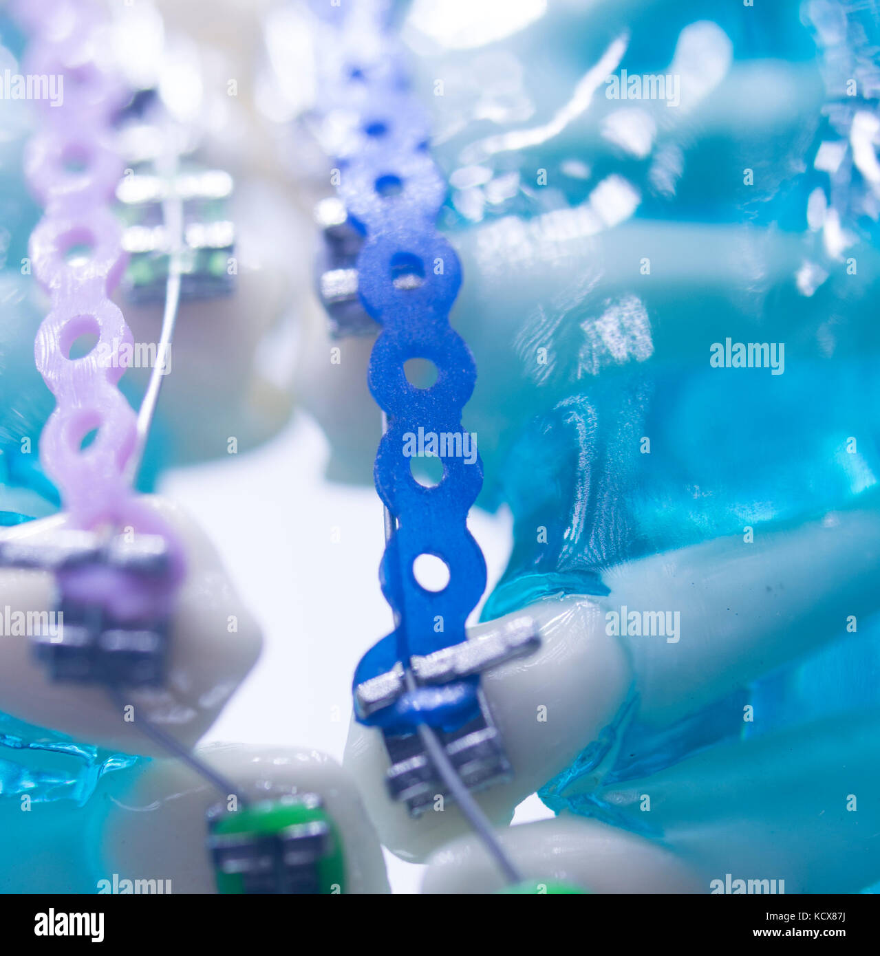 Dental teeth retainers metal aligners brackets to straighten teeth in ...