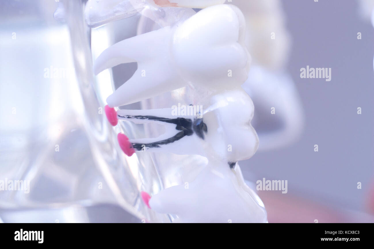 Dental teeth mouth dentists teaching model with teeth, gums, molars and ...