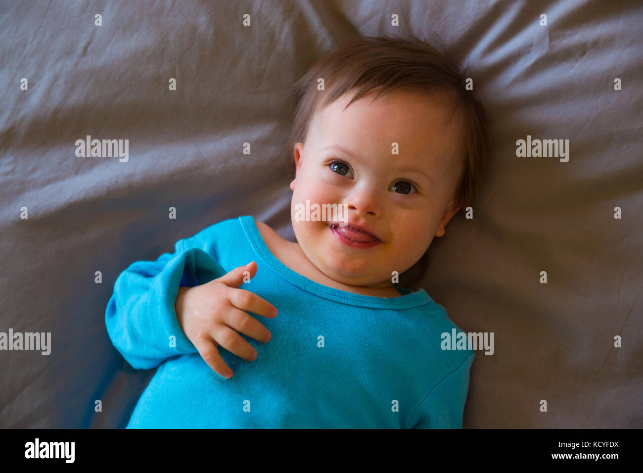Portrait of cute baby boy with Down syndrome Stock Photo - Alamy
