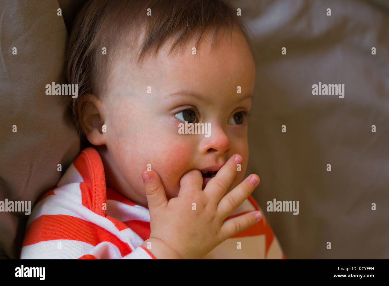 Portrait of cute baby boy with Down syndrome Stock Photo - Alamy
