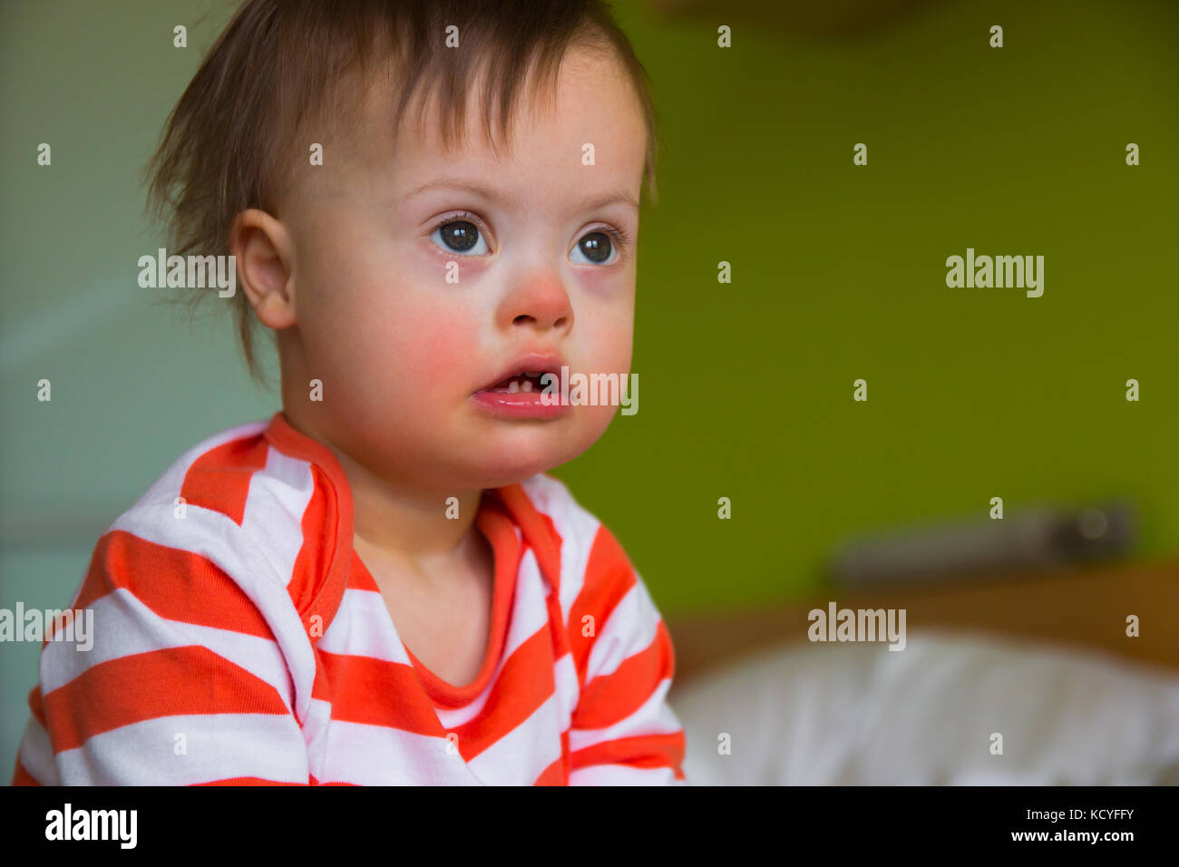 Portrait Of Cute Baby Boy With Down Syndrome Stock Photo Alamy Portrait Of Cute Baby Boy With Down Syndrome Stock Photo Alamy