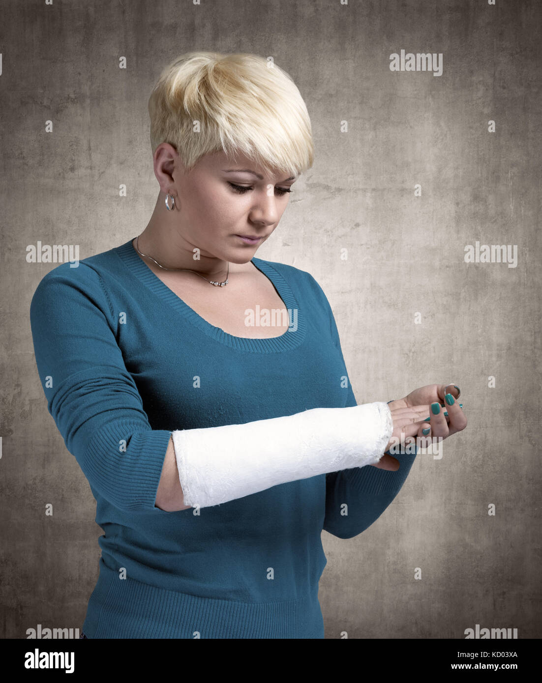 Arm cast girl hi-res stock photography and images - Alamy
