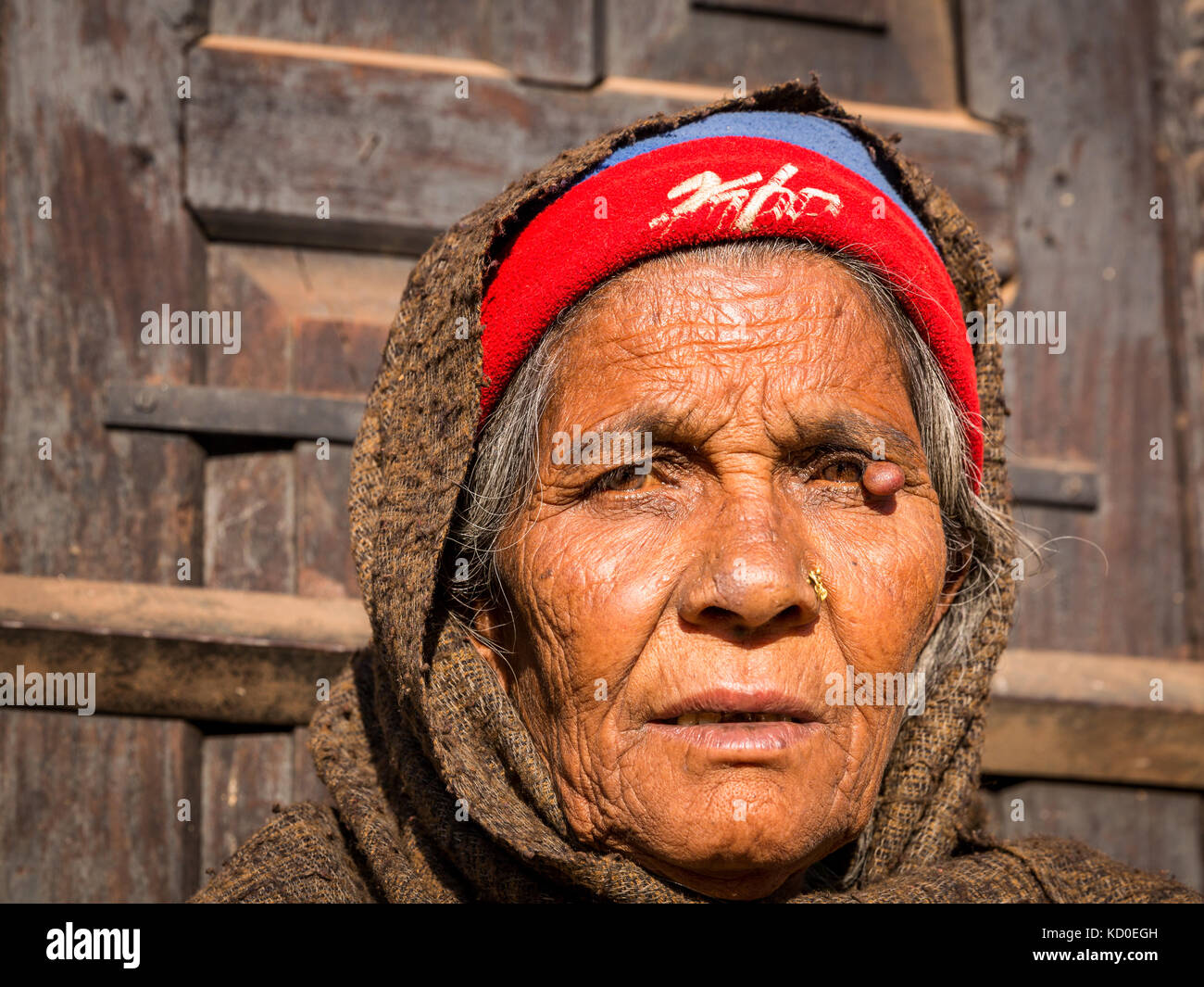 Warts face hi-res stock photography and images - Alamy