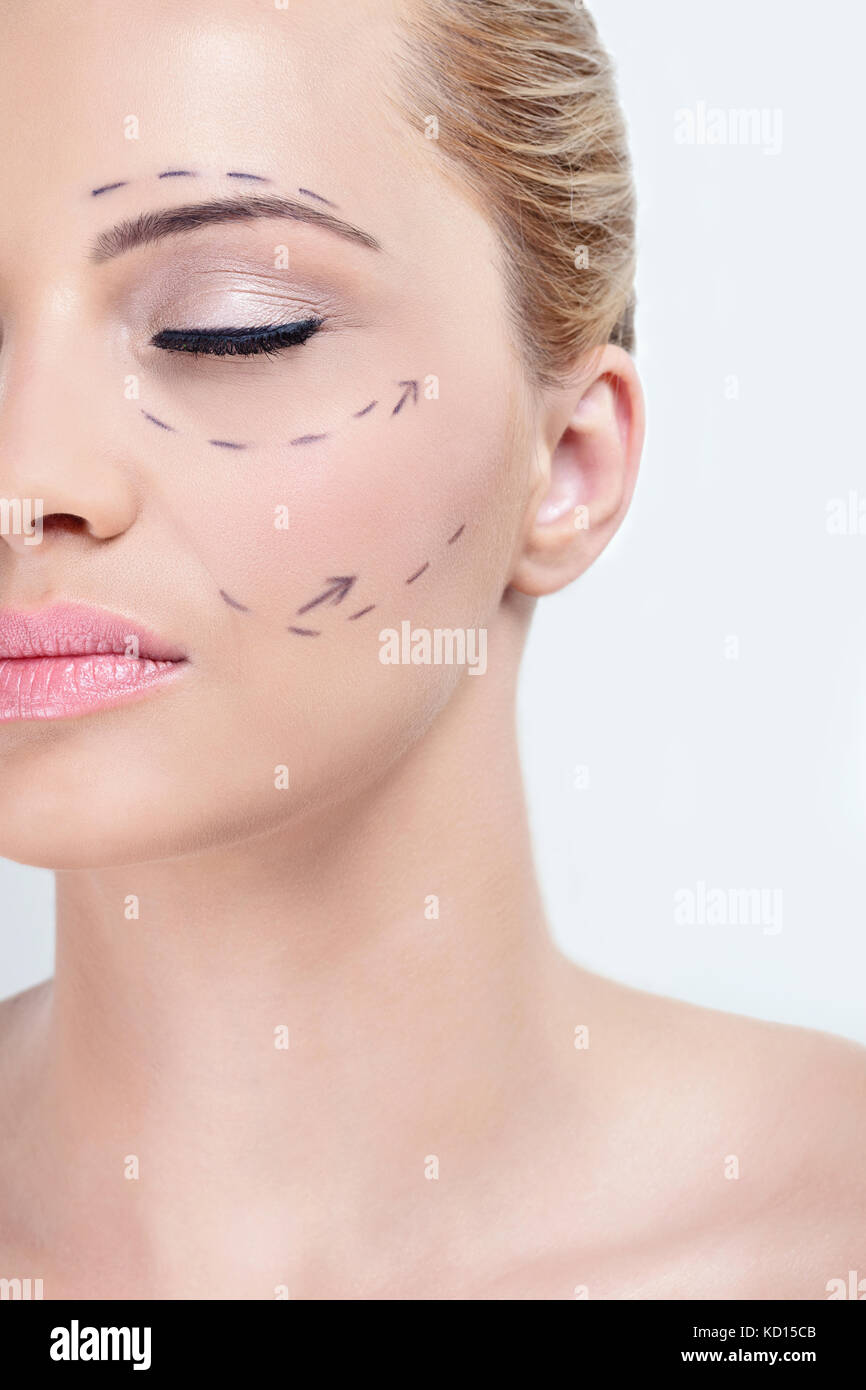 close up of woman face with correction lines, before plastic surgery ...