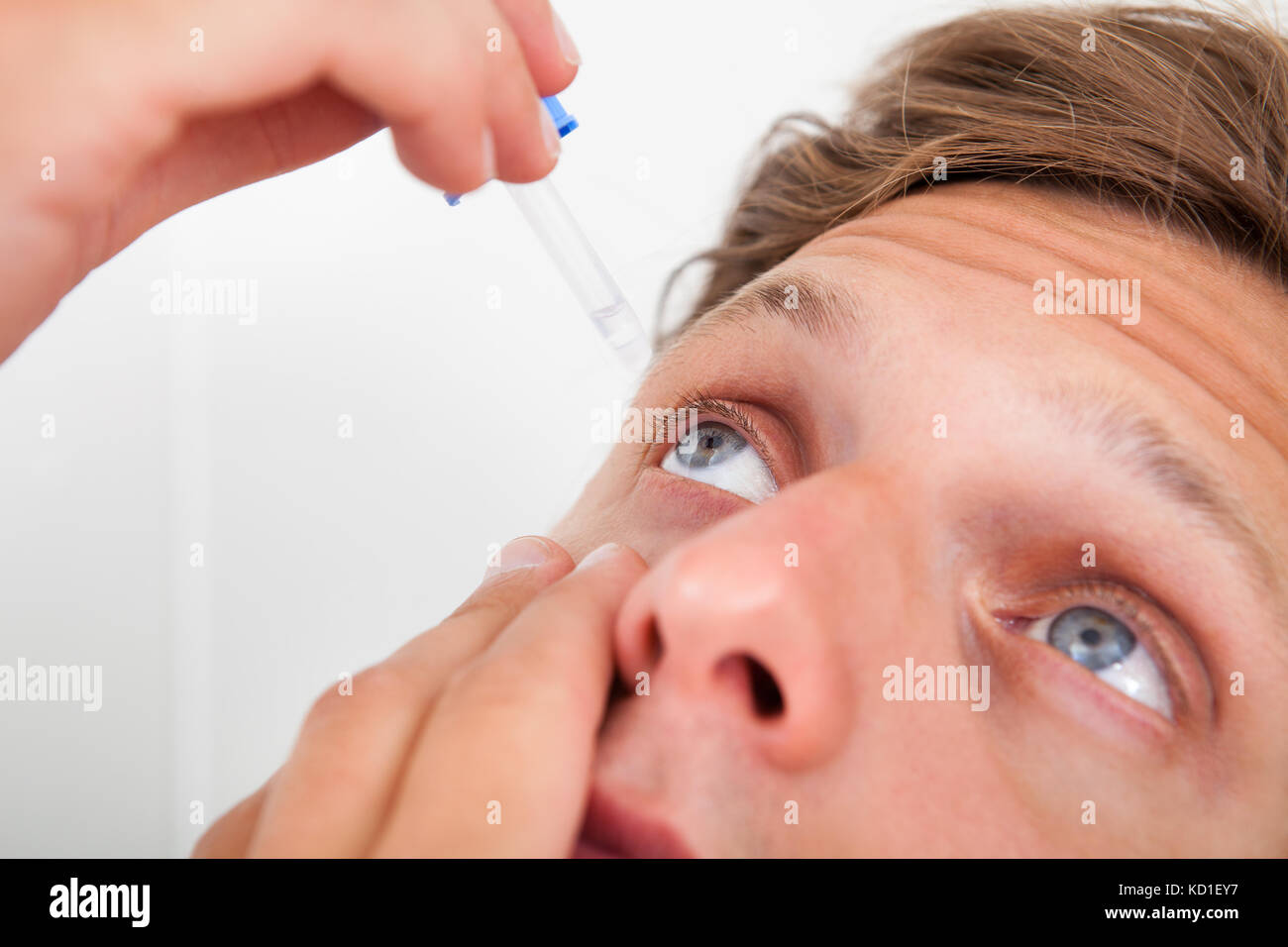 Close-up Of A Young Man Putting Eye Drops In His Eyes Stock Photo - Alamy