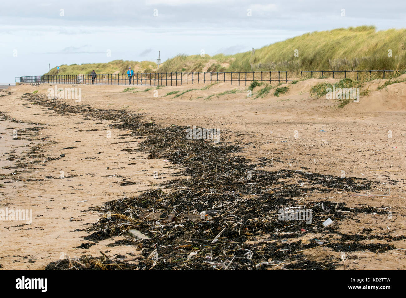 Human bladder sand hi-res stock photography and images - Alamy
