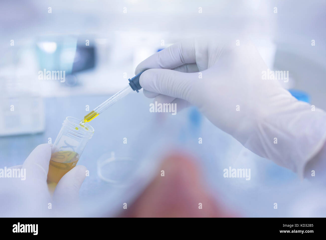 Laboratory worker taking liquid from test tube, using pipette, close-up ...