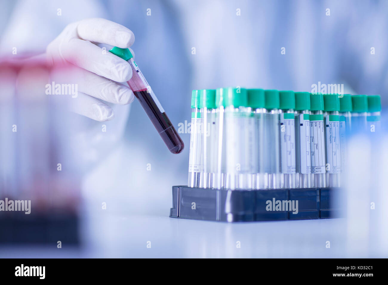Laboratory worker placing liquid filled test tube in rack. close-up ...