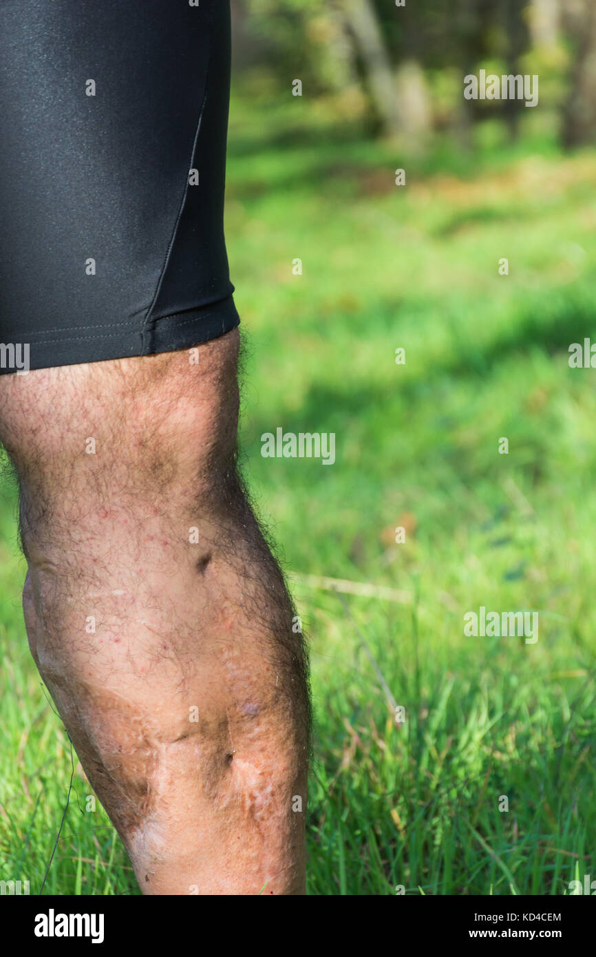 Hairless epidermis hi-res stock photography and images - Alamy