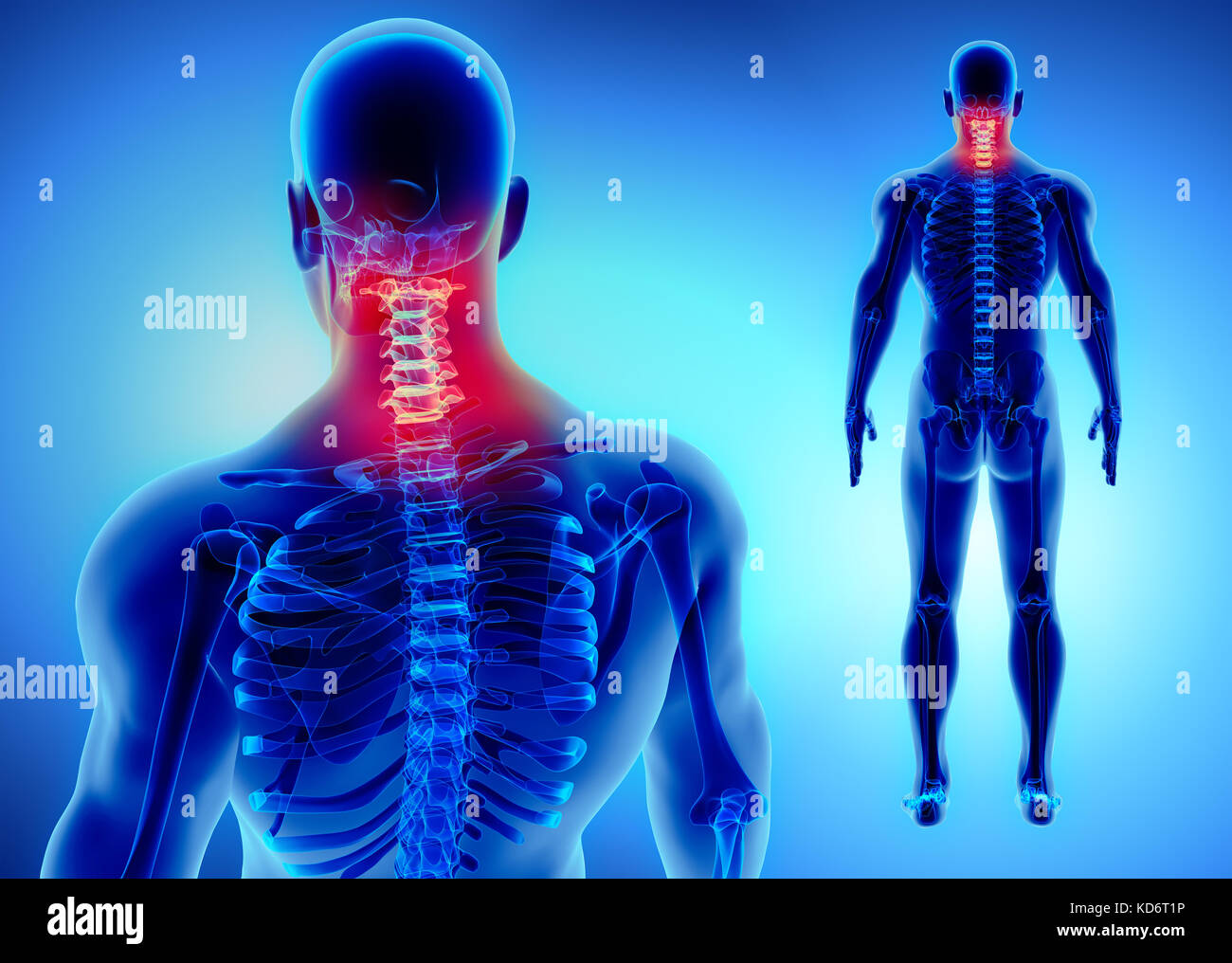 3D illustration of Cervical Spine - Part of Human Skeleton Stock Photo ...