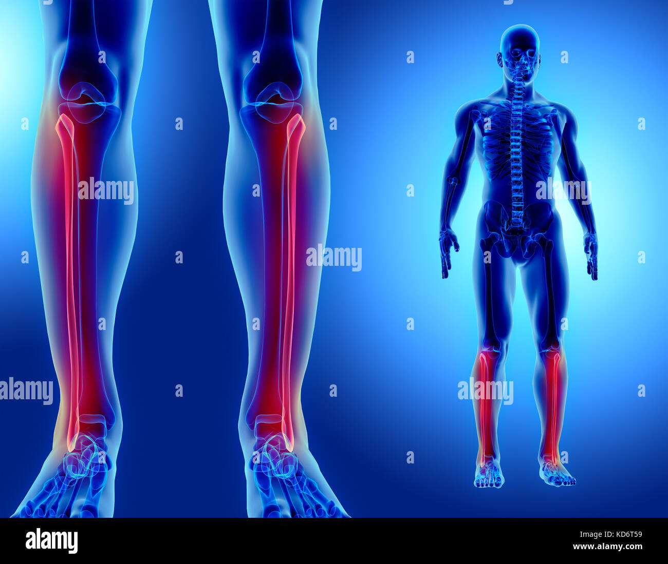 3d render medical illustration femur hi-res stock photography and ...
