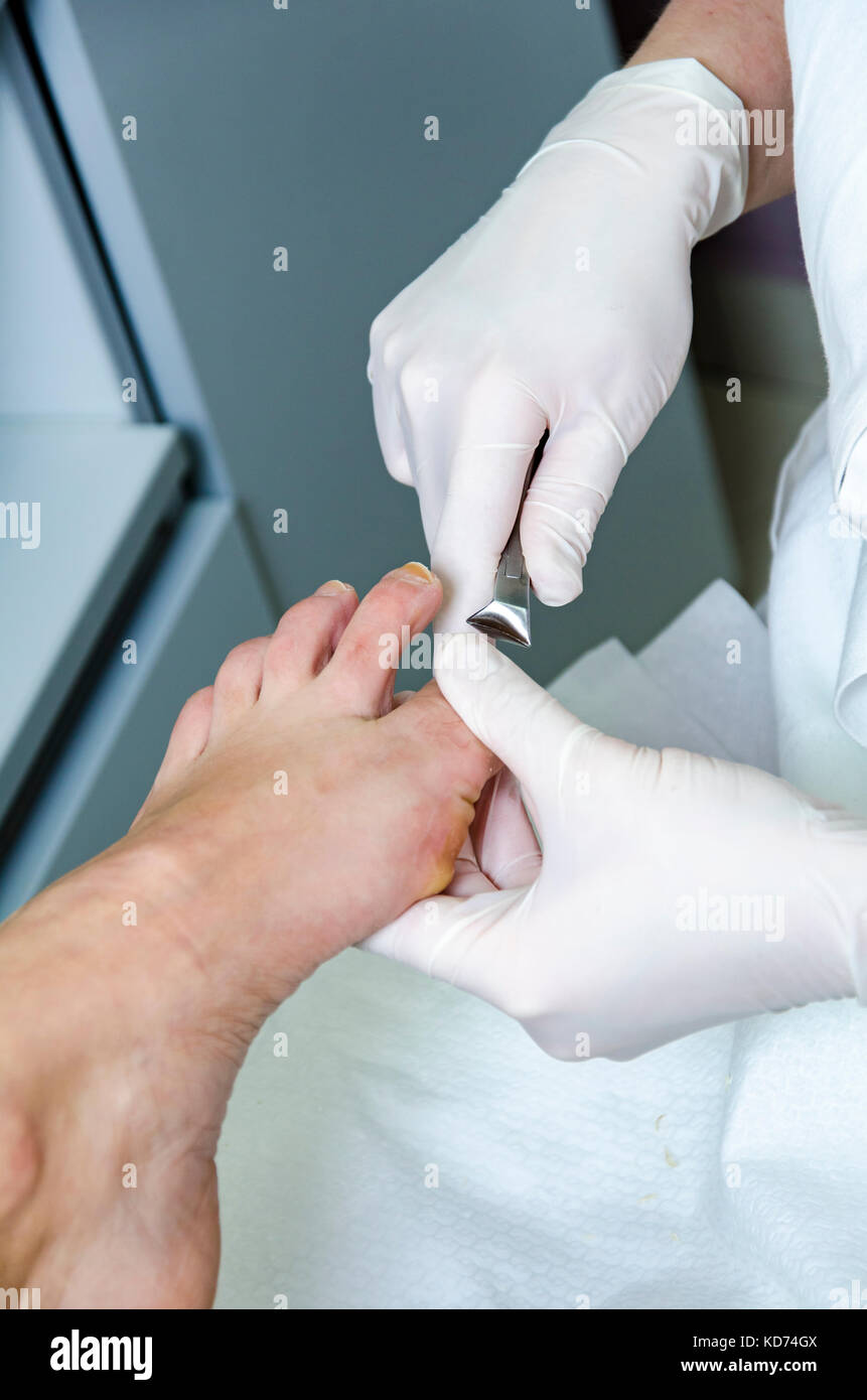 Medicine pedicure hi-res stock photography and images - Alamy