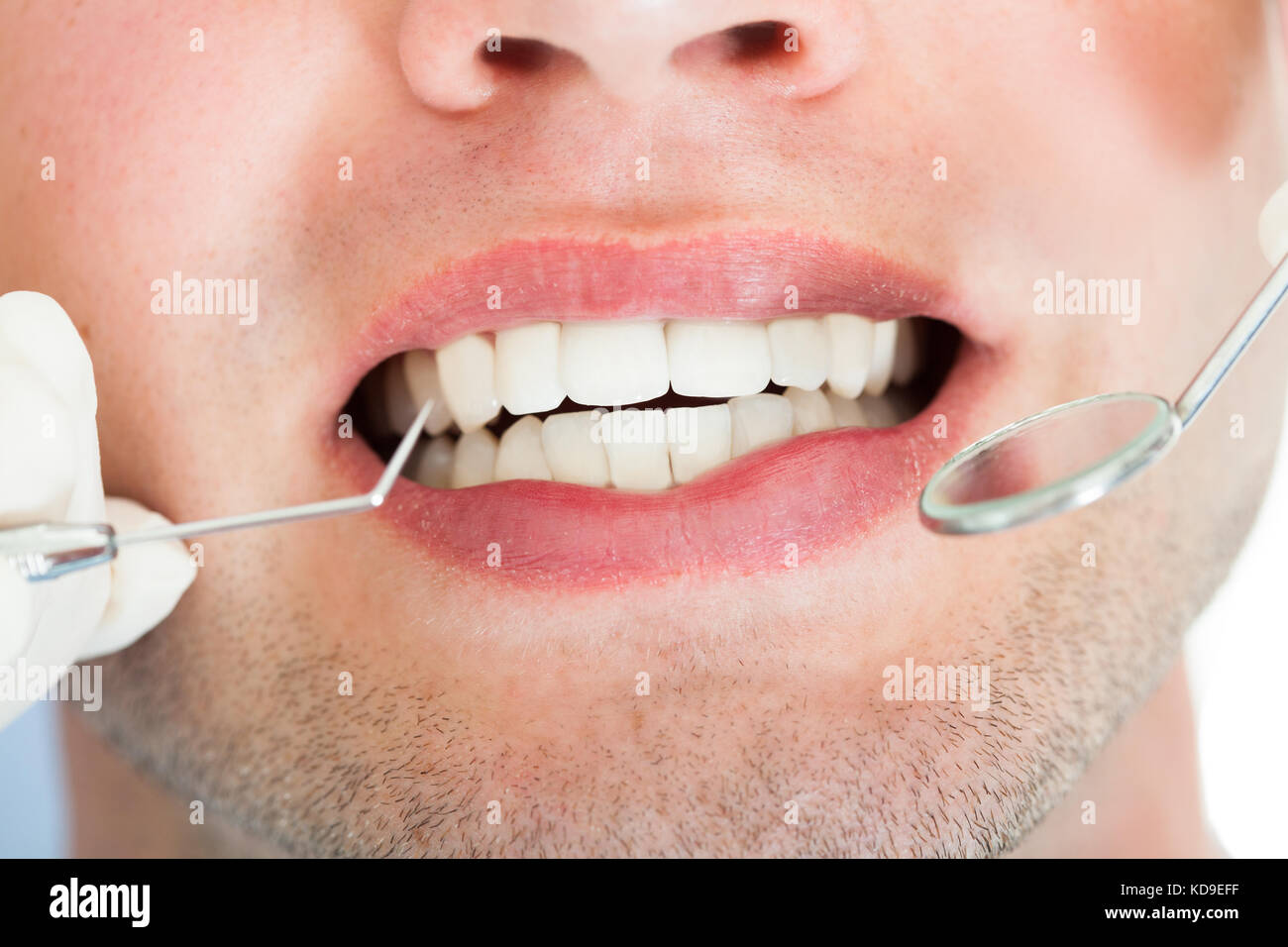 Close up dentist analyzing hi-res stock photography and images - Alamy