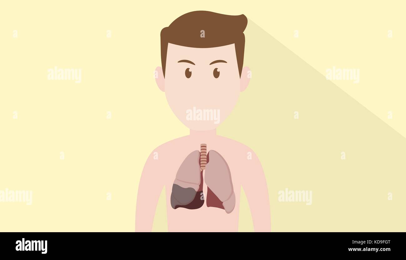 human body cartoon face with pneumonia ill sick lung vector Stock ...