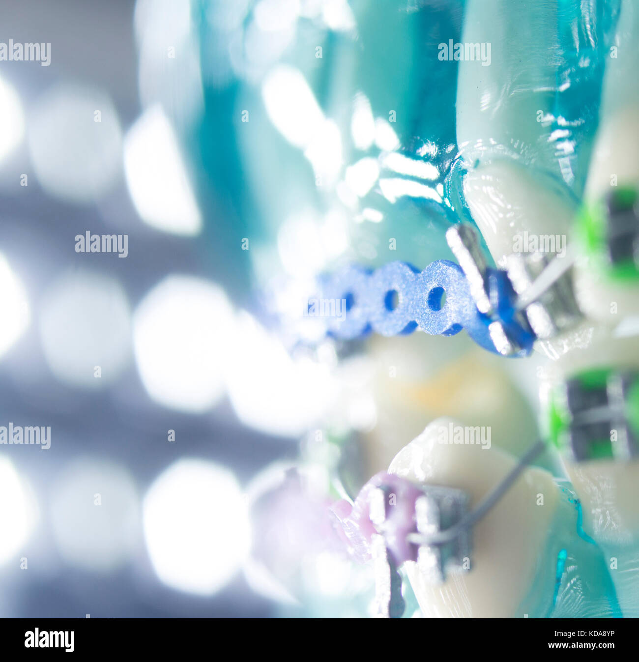 Dental teeth retainers metal aligners brackets to straighten teeth in ...