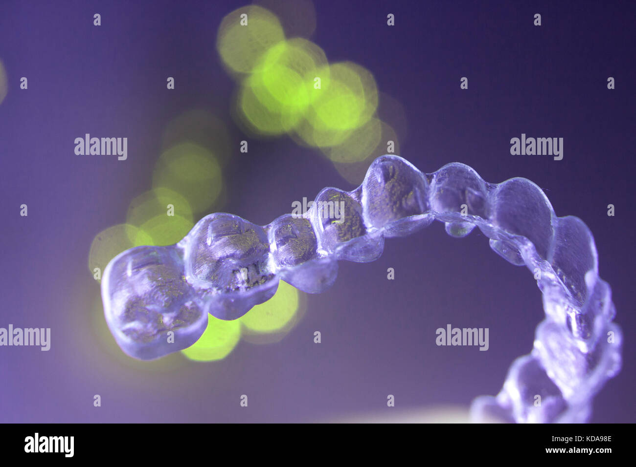 Invisible teeth retainers orthodontic brackets. Plastic modern ...