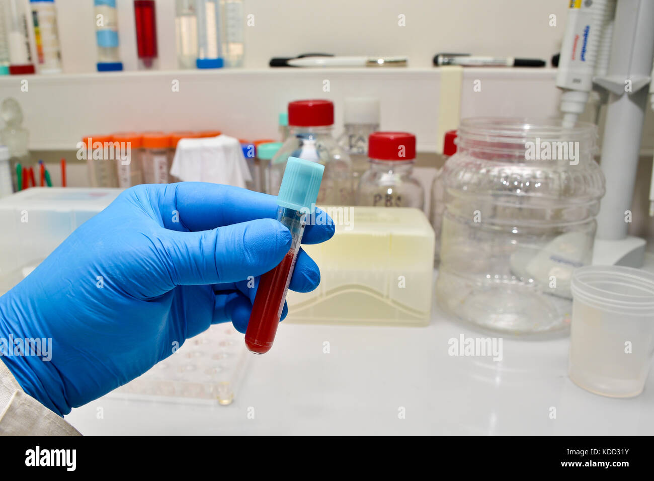 Test biochemistry hi-res stock photography and images - Alamy