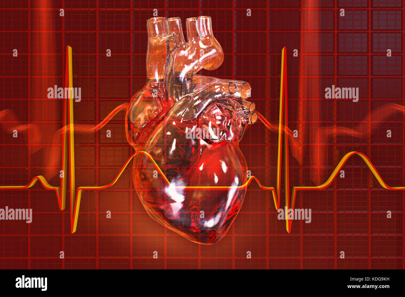 Computer illustration of the heart with coronary vessels and ...