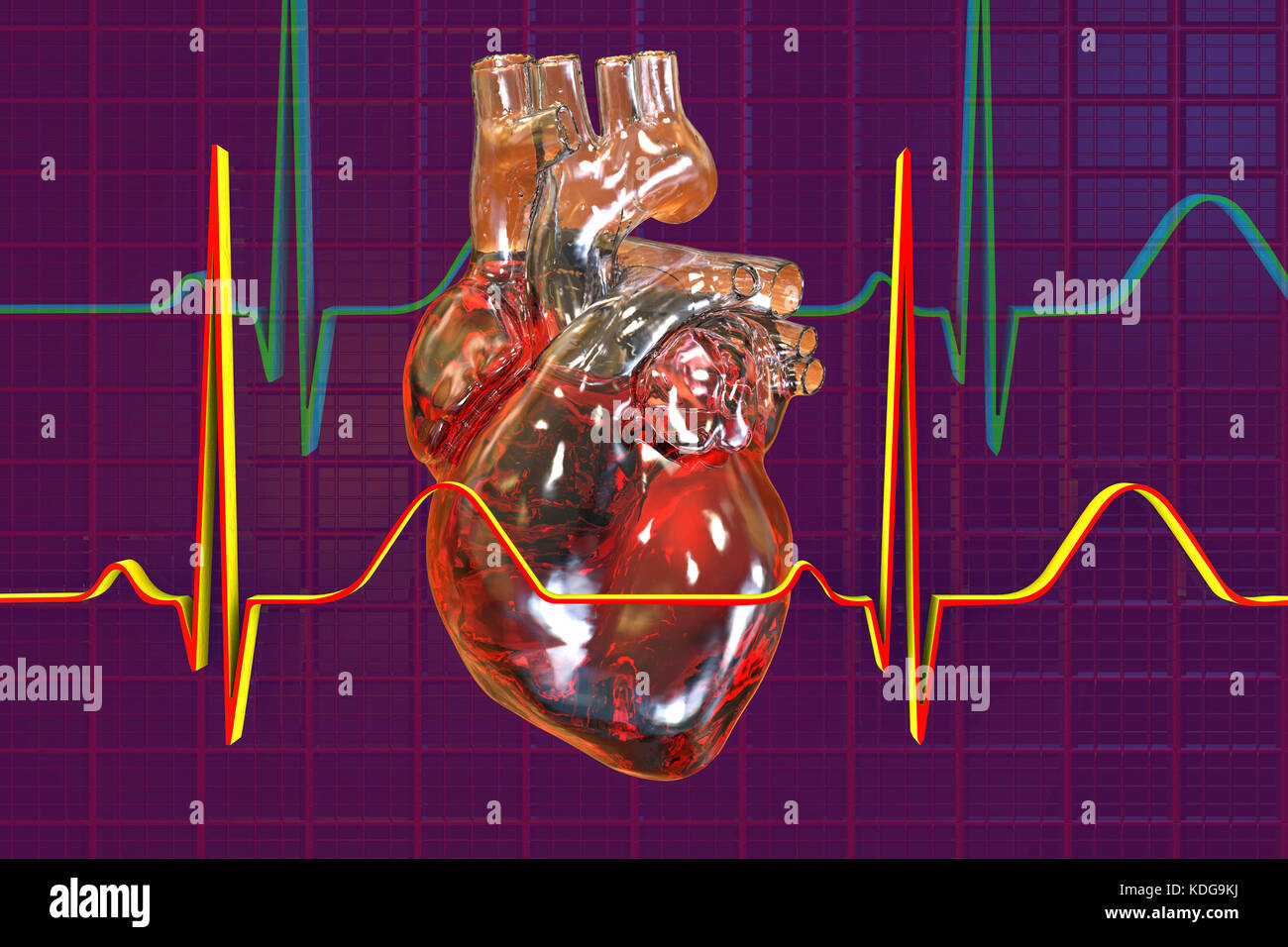 Computer illustration of the heart with coronary vessels and ...