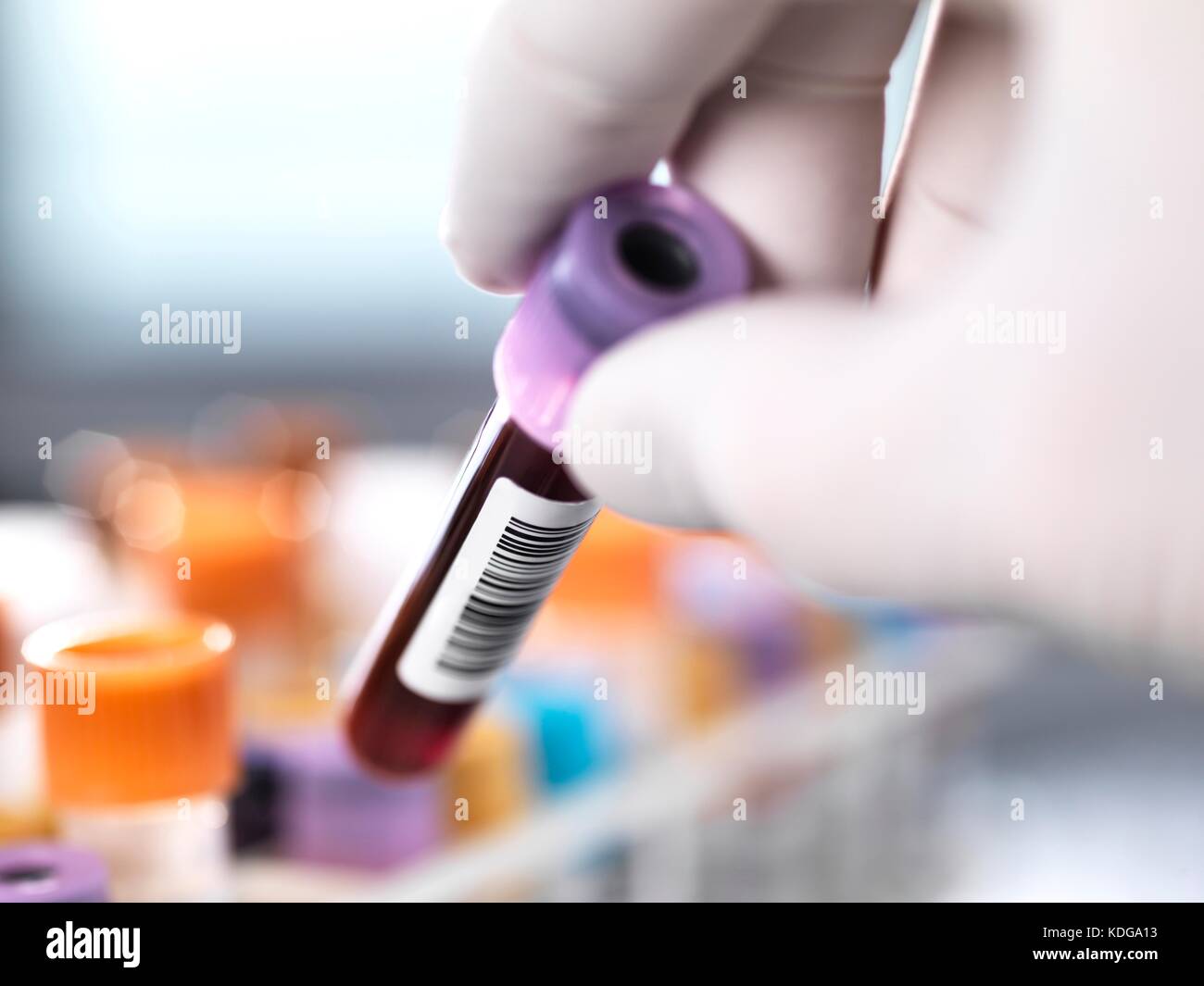 Researcher taking blood sample from a rack of medical samples Stock ...