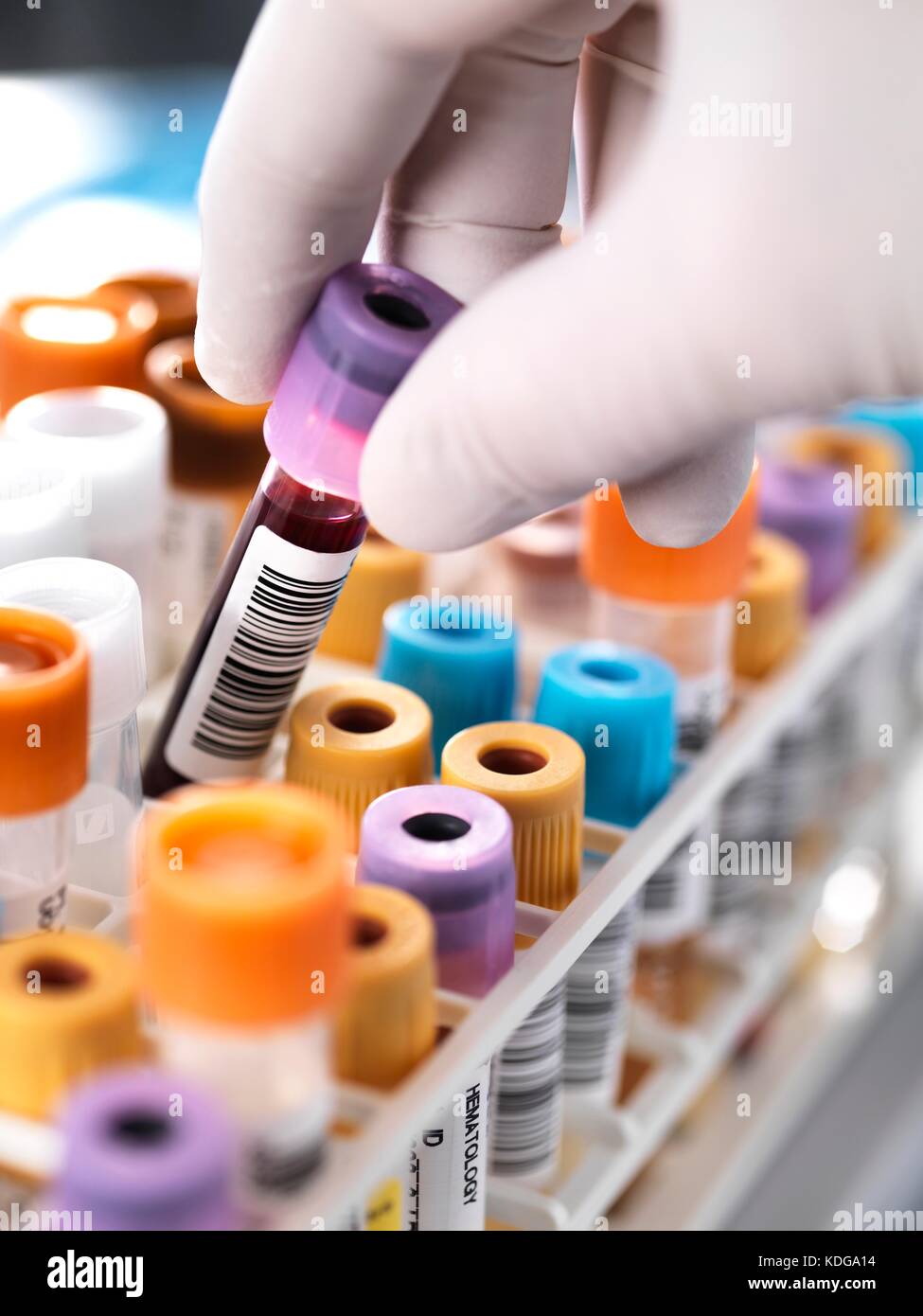 Researcher taking blood sample from a rack of medical samples Stock ...