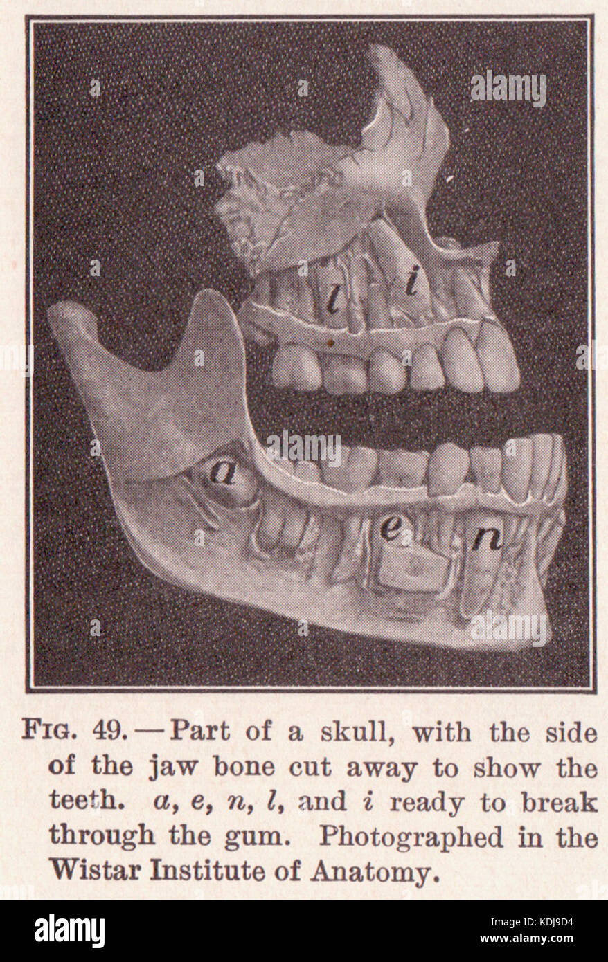 Jaw analysis hi-res stock photography and images - Alamy