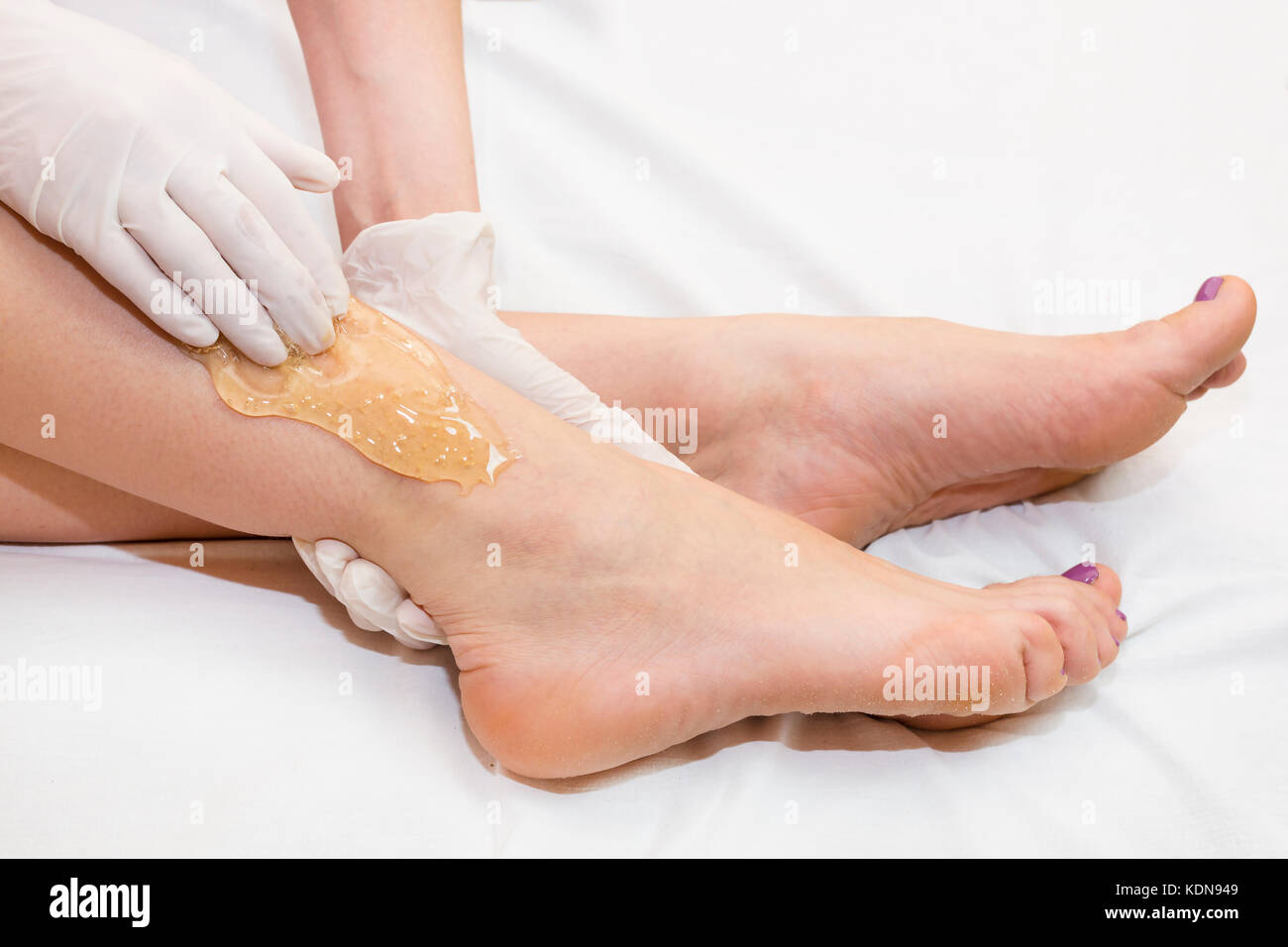 Epilation sugar processes woman passes in a beauty salon Stock Photo ...