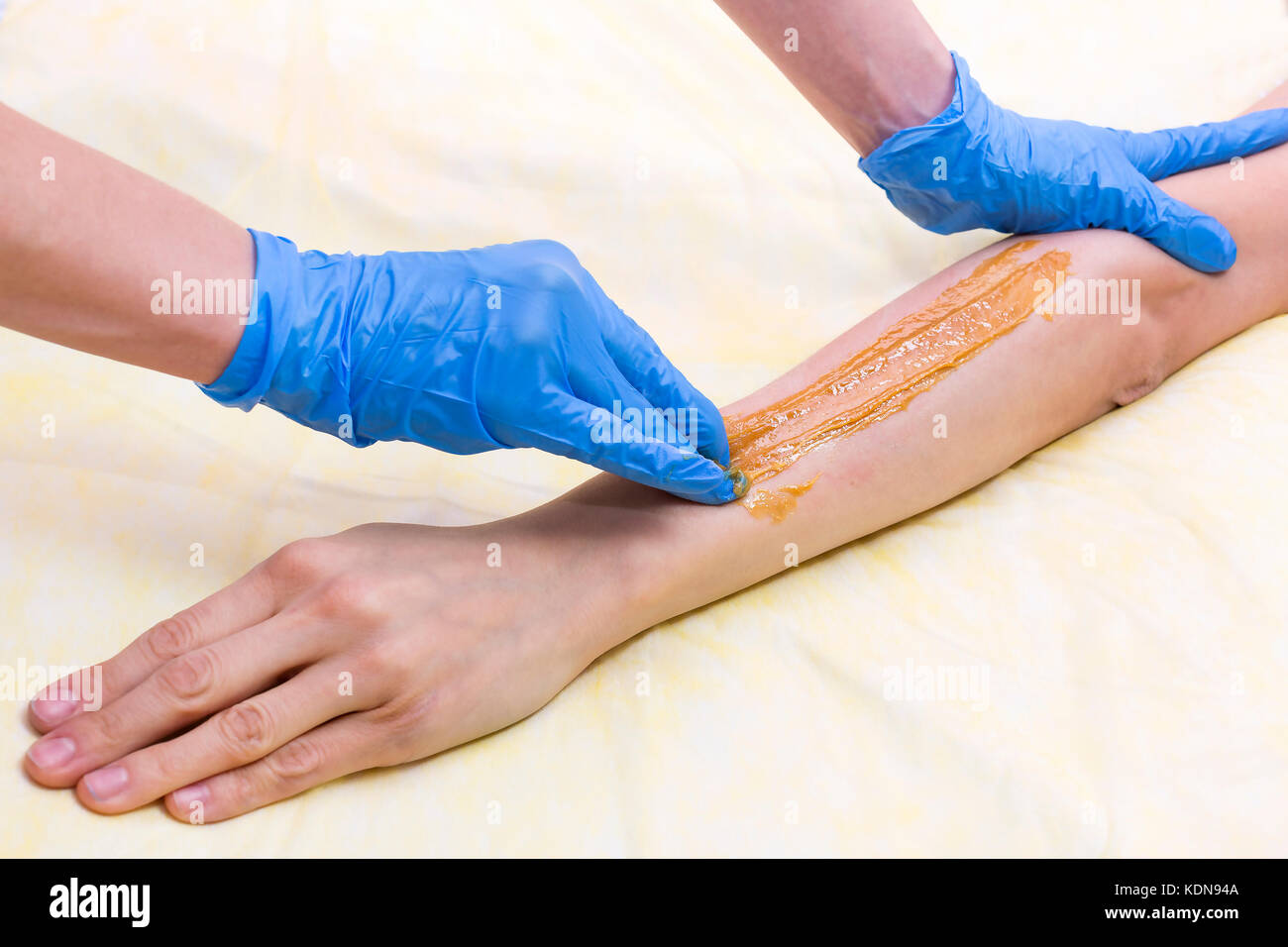 Epilation sugar processes woman passes hi-res stock photography and ...