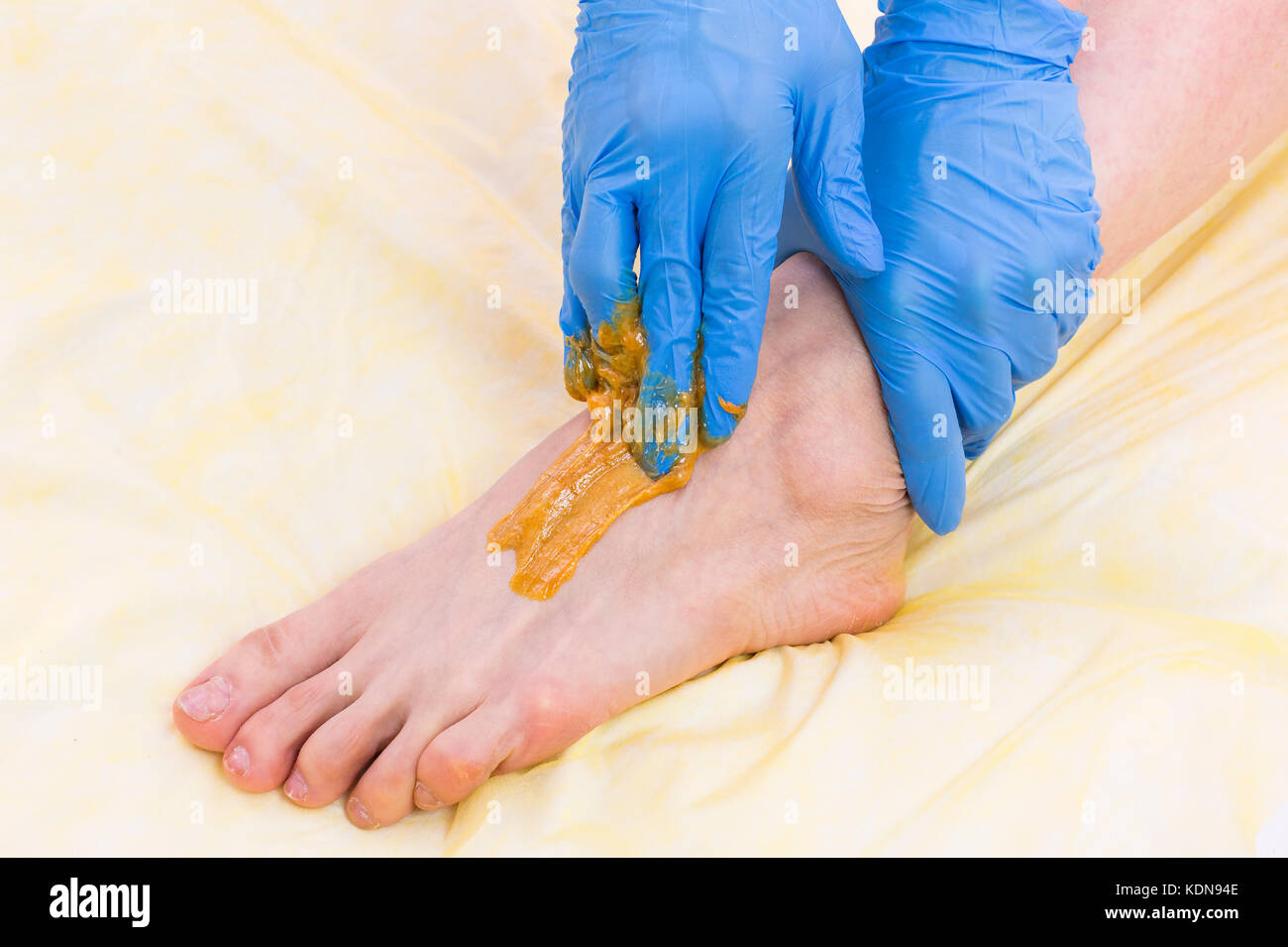 Epilation sugar processes woman passes hi-res stock photography and ...