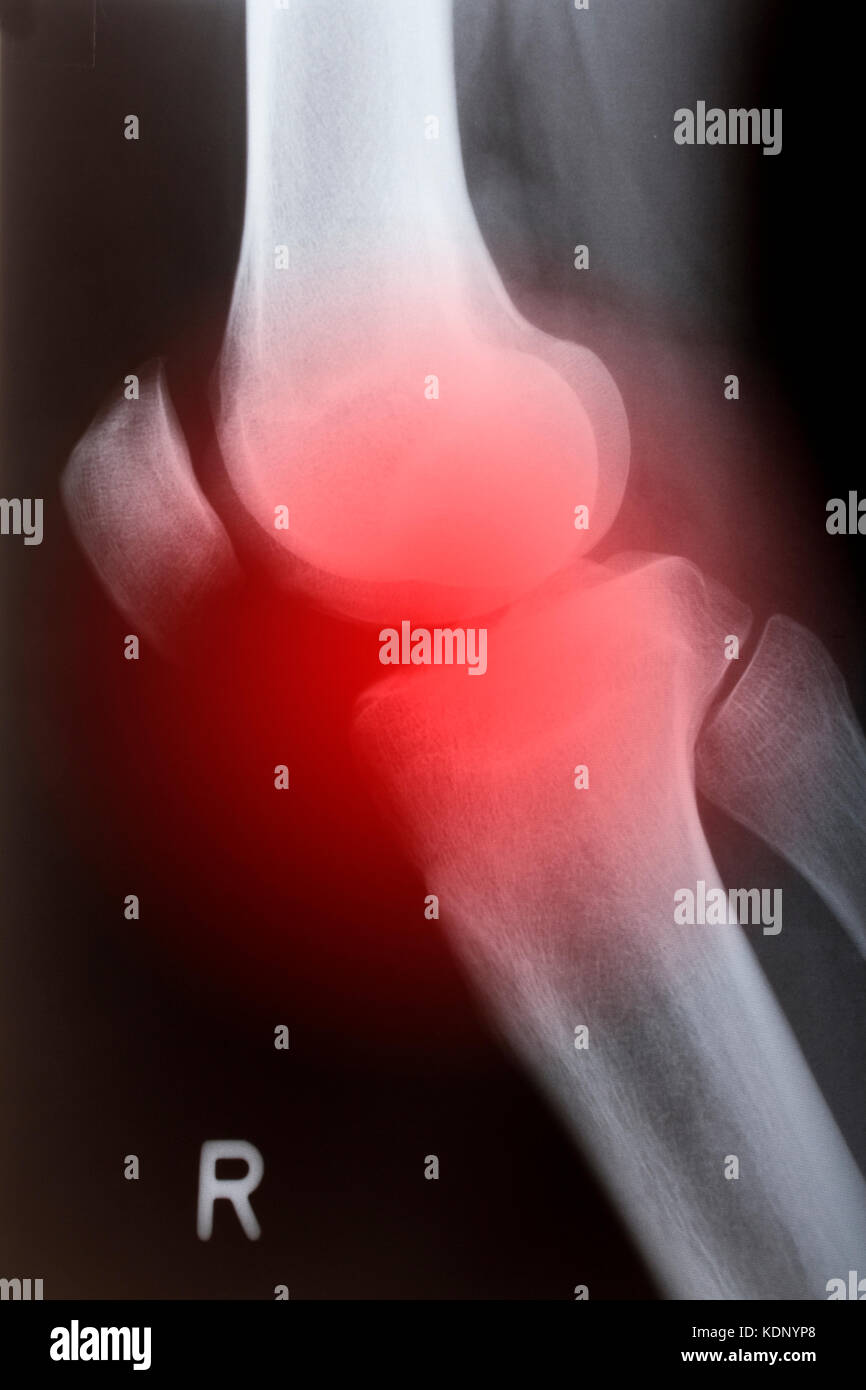 Sidelong hi-res stock photography and images - Alamy