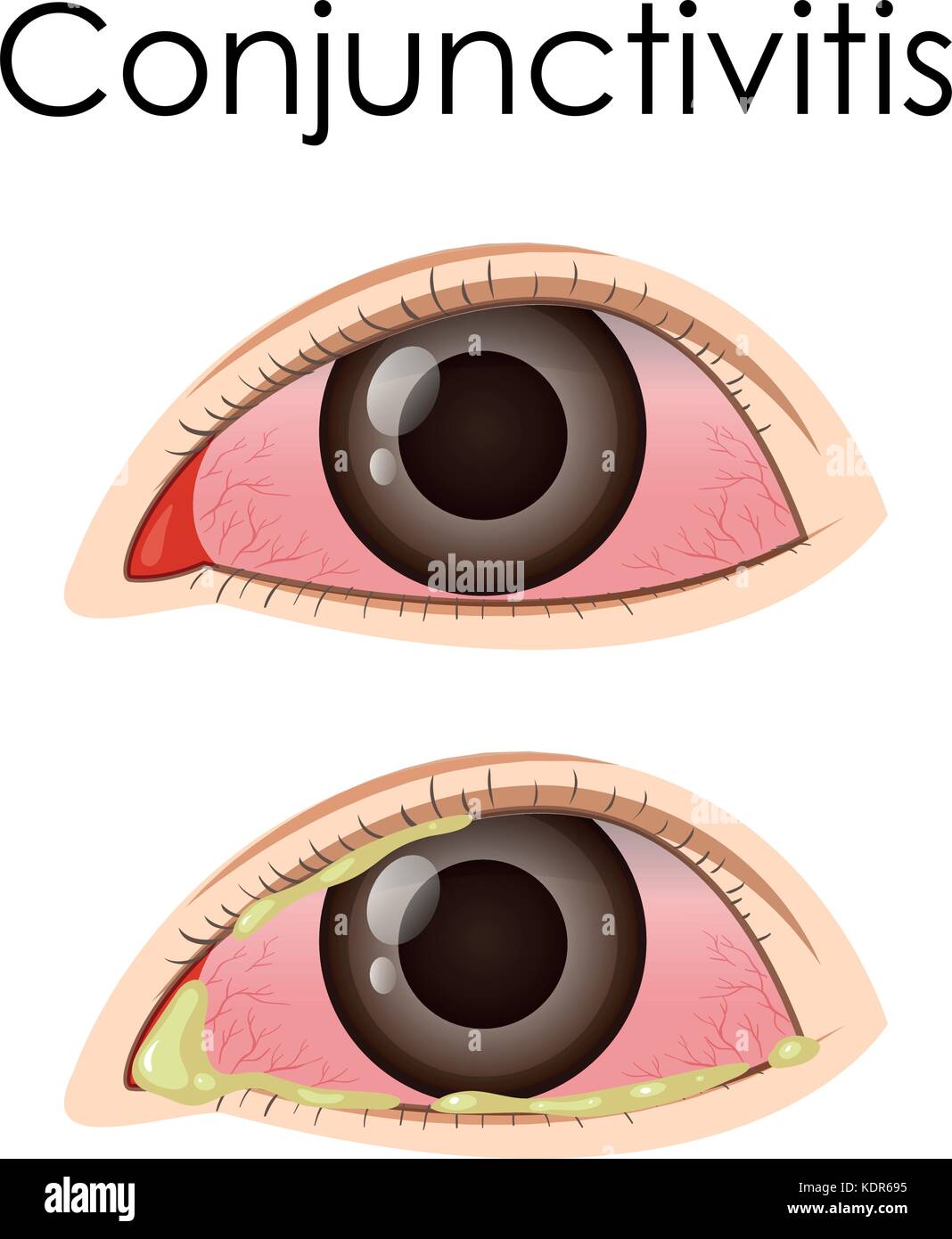 Conjunctiva Diagram