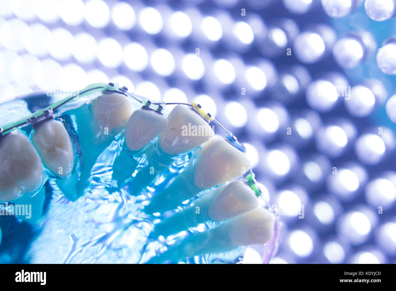 Dental teeth retainers metal aligners brackets to straighten teeth in ...