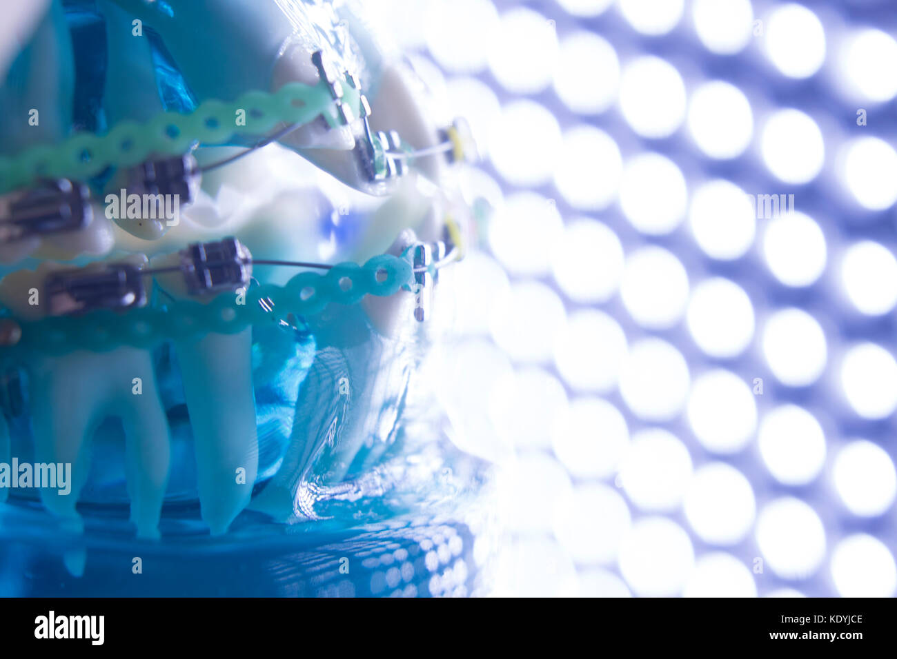 Dental teeth retainers metal aligners brackets to straighten teeth in ...