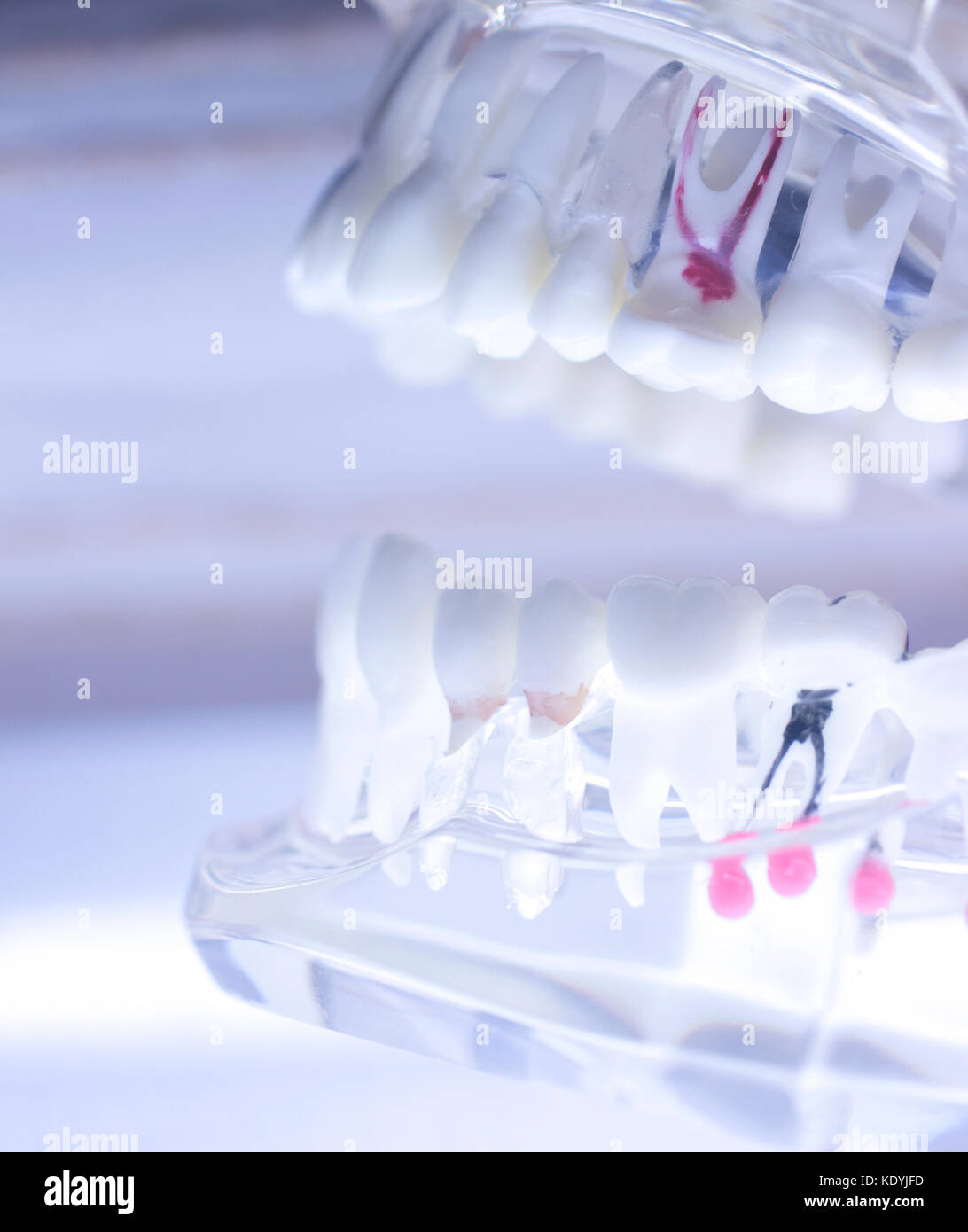 Dental teeth mouth dentists teaching model with teeth, gums, molars and ...